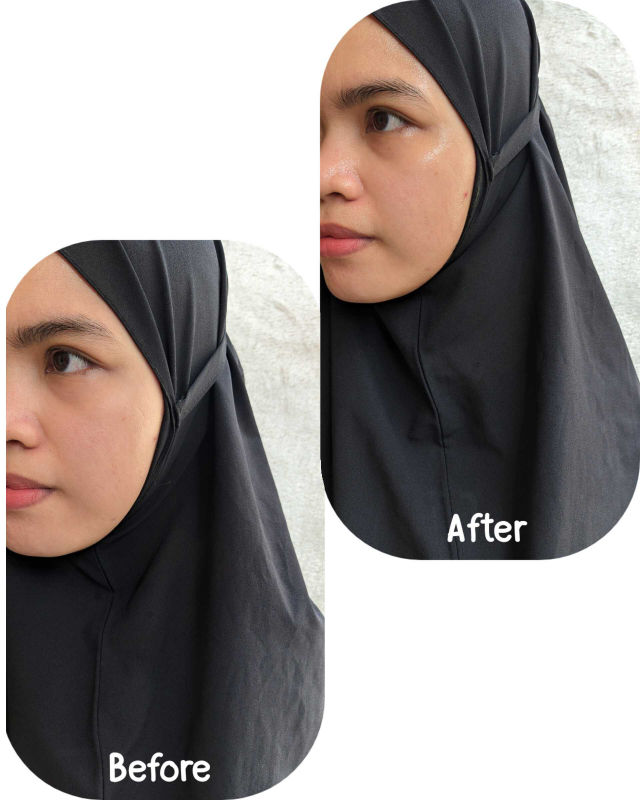 Poremizing Light Gel Cream | SKIN1004